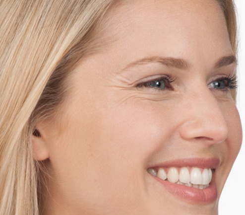 Pittsburgh Botox Treatment | Vujevich Dermatology Associates