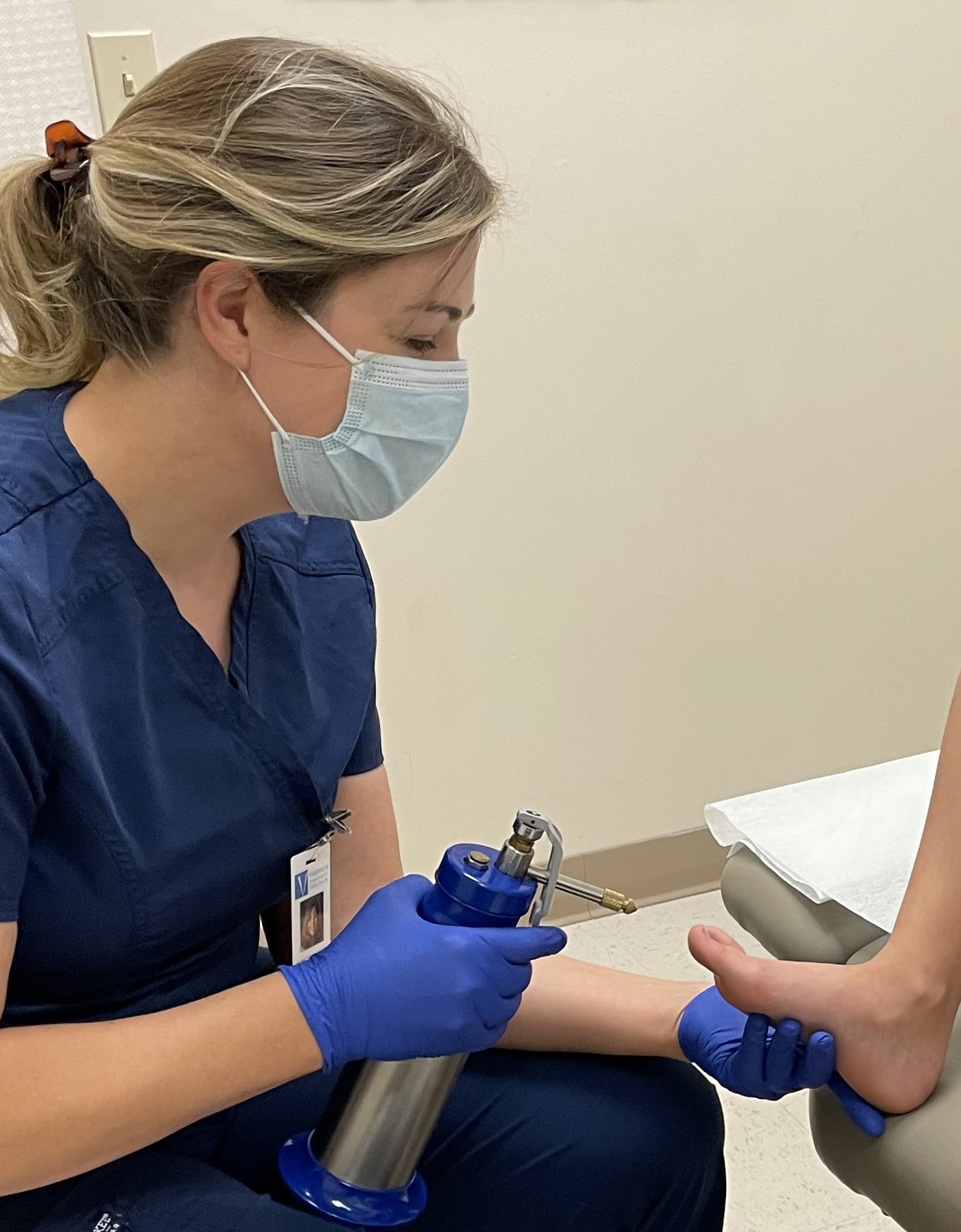 Warts Treatment | Vujevich Dermatology Associates